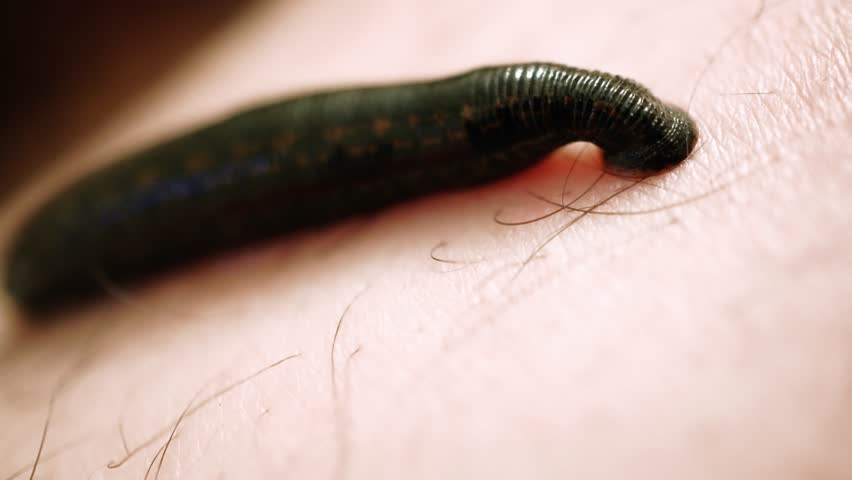Leech Stock Video Footage - 4K and HD Video Clips | Shutterstock