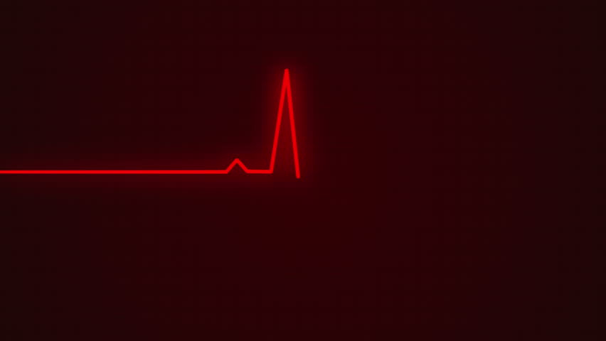 ECG Health Medical Monitor With Beep Stock Footage Video 8442280 ...