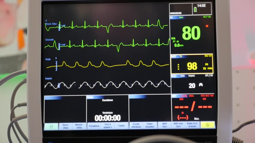 Heart Monitor With Curves Oxygen Saturation Blood Pressure Ecg ...