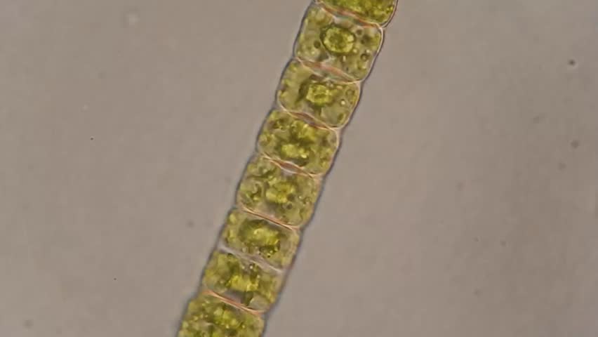 Seaweed (algae) Under Microscope, Magnification 400x 스톡 동영상 비디오 4386914 ...