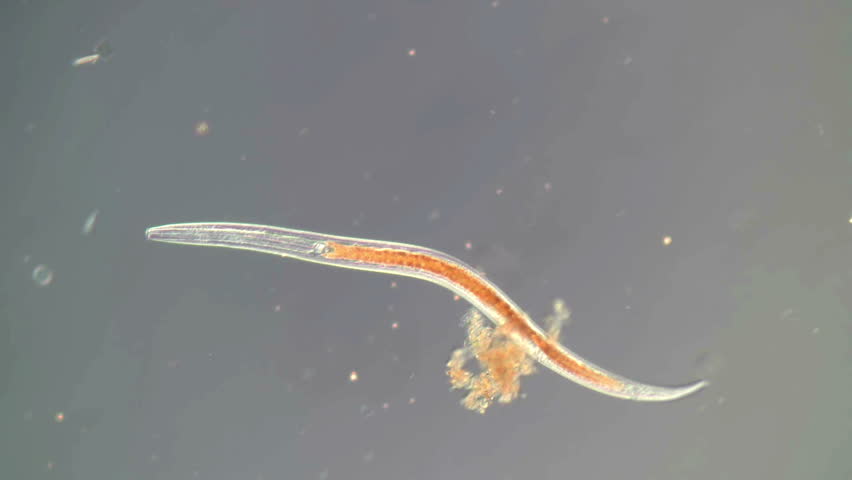 Nematode Under Microscope Varastovideo 20942548 | Shutterstock