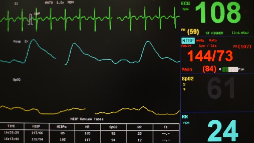 Overall Nurses Station Monitor In The Neonatal Intensive Care Unit ...