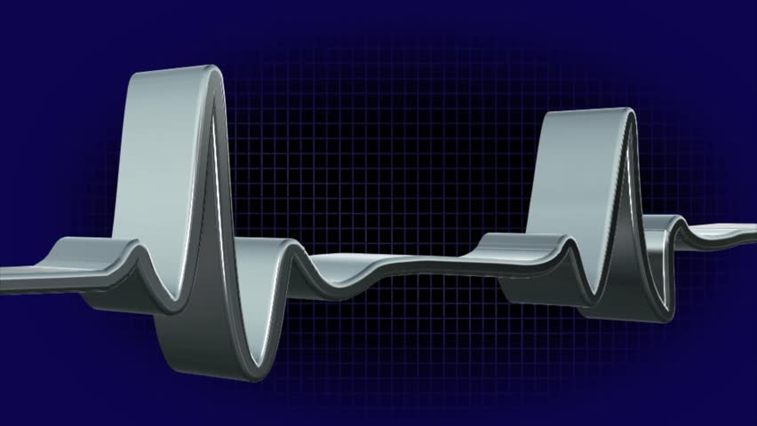 A 3d Ekg Line with Stock Footage Video (100% Royalty-free) 2546675 ...