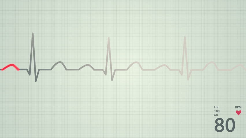 Animation Of Schematic Diagram Of Normal Sinus Rhythm For A Human Heart ...