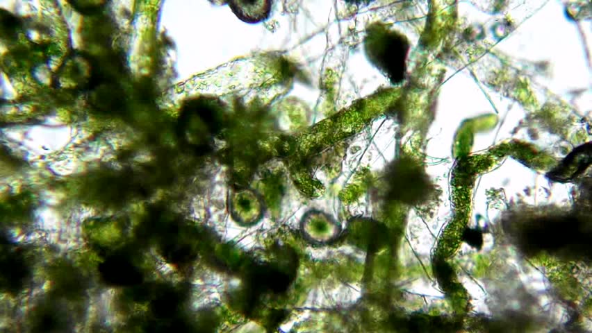 Seaweed (algae) Under Microscope, Magnification Stock Footage Video ...