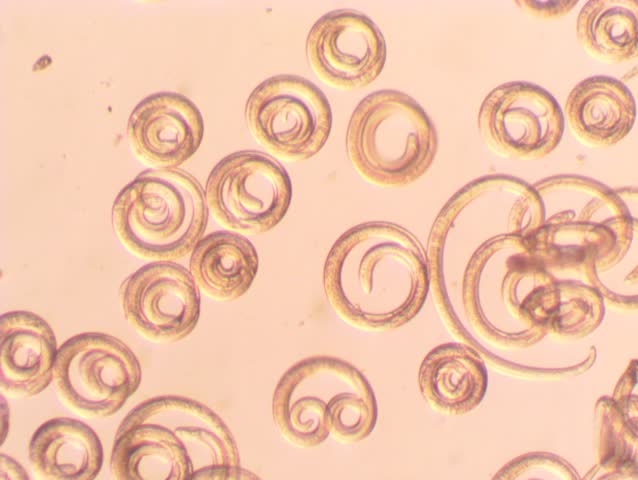 Stock Video Clip of Parasitic worm Trichinella spiralis in a sample ...