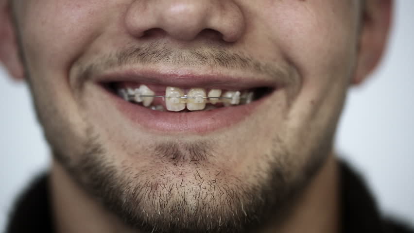 Closeup At Beard Man Face, Mouth And White Teeth View, Smile Boy ...