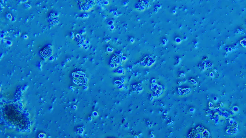 Plaque Bacteria From Mouth Seen In Phase Microscope 600x With Green ...
