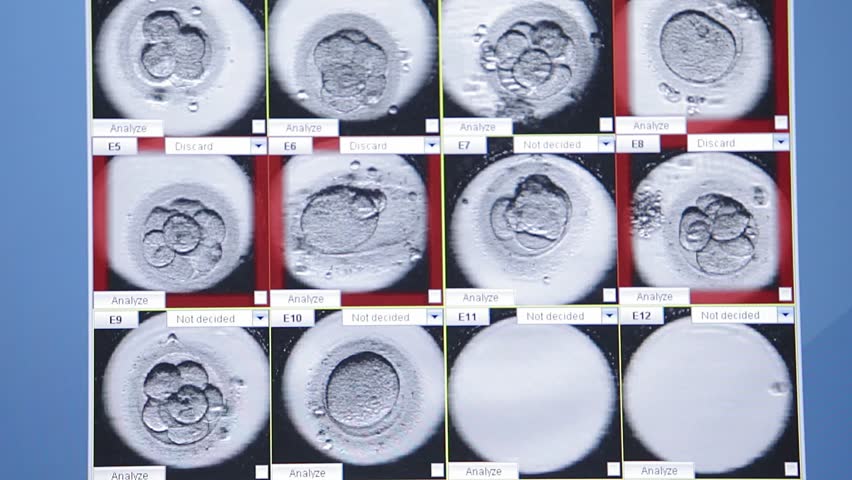 Human Embryos Development On Lab Stock Footage Video (100% Royalty-free ...