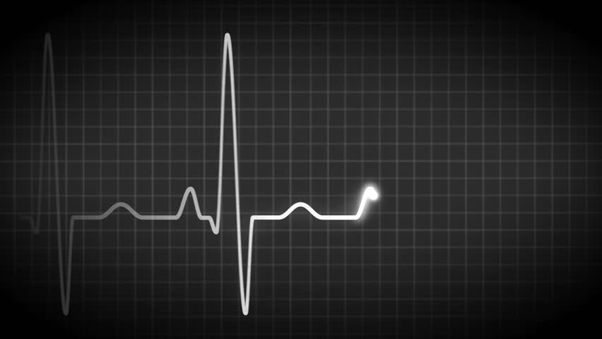 Stock video of black and white ecg aka | 9544565 | Shutterstock